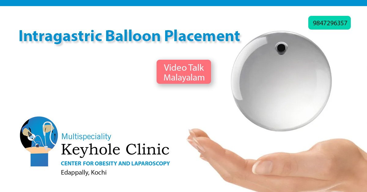 Intragastric Balloon Placement - Video Talk (Malayalam) - Dr. R. Padmakumar