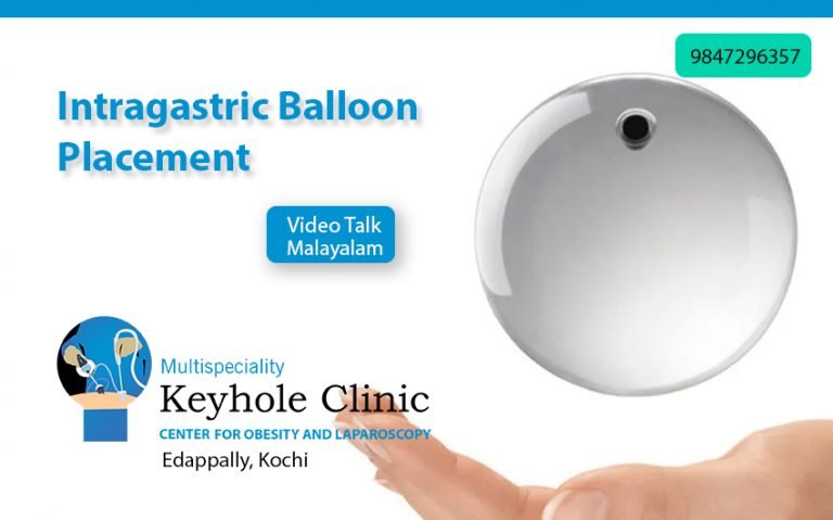 Intragastric Balloon Placement - Video Talk (Malayalam) - Dr. R. Padmakumar