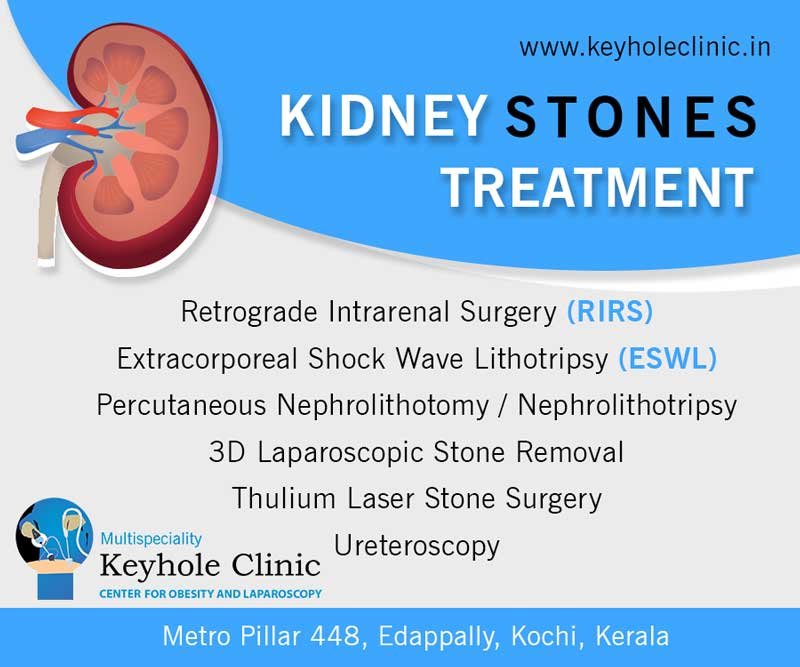 Kidney Stones Treatment In Kerala Kochi Keyhole Clinic
