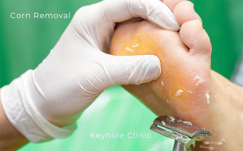 Skin Clinic at Edappally | Dermatology - Keyhole Clinic