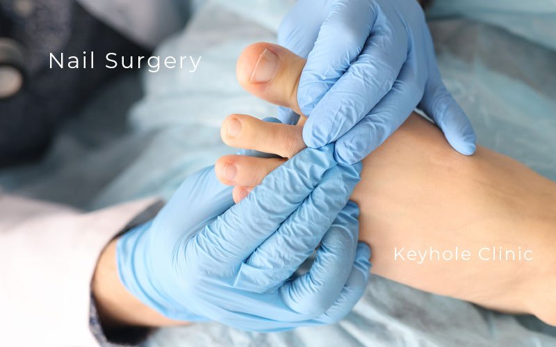 Skin Clinic at Edappally | Dermatology - Keyhole Clinic