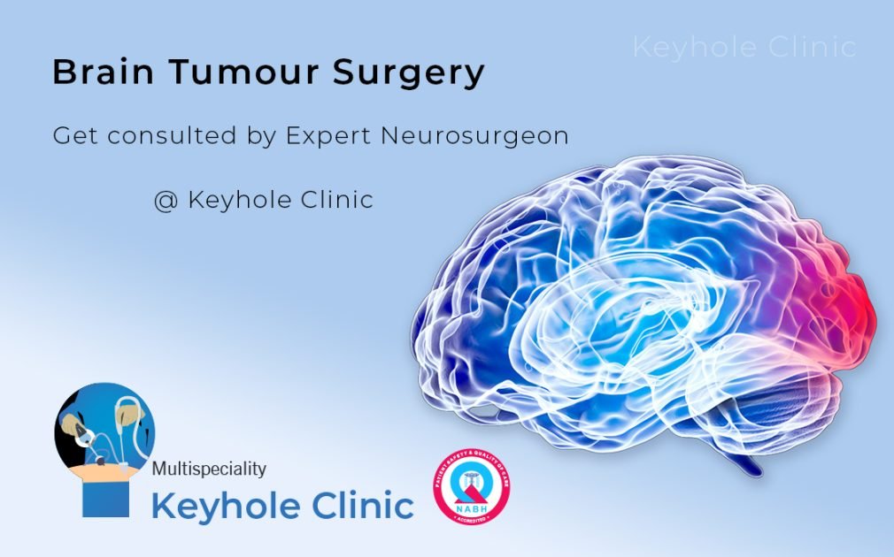 Brain Tumour Surgery in Kerala